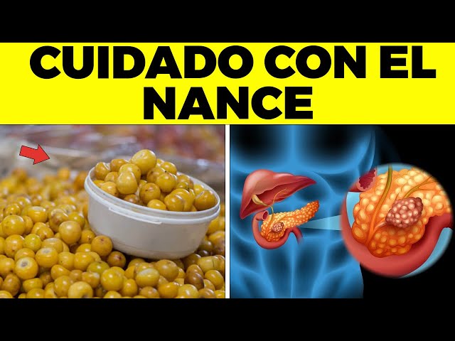 🌟 ¡Descubre los Increíbles Beneficios de Comer Nance Diario! 🍏