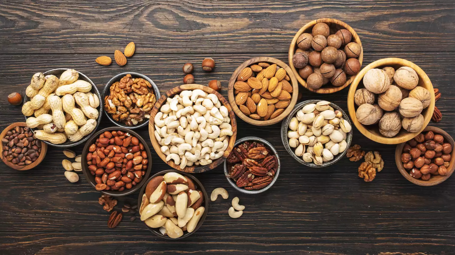 🌰 ¡Descubre Alternativas Increíbles para las Alergias a Frutos Secos! 🧠